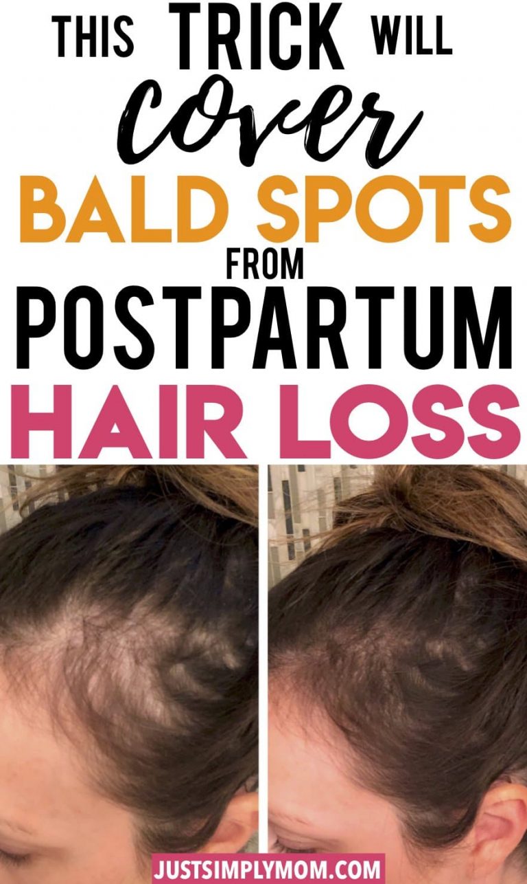 How to Quickly Cover Bald Spots During Postpartum Hair Loss - Just ...