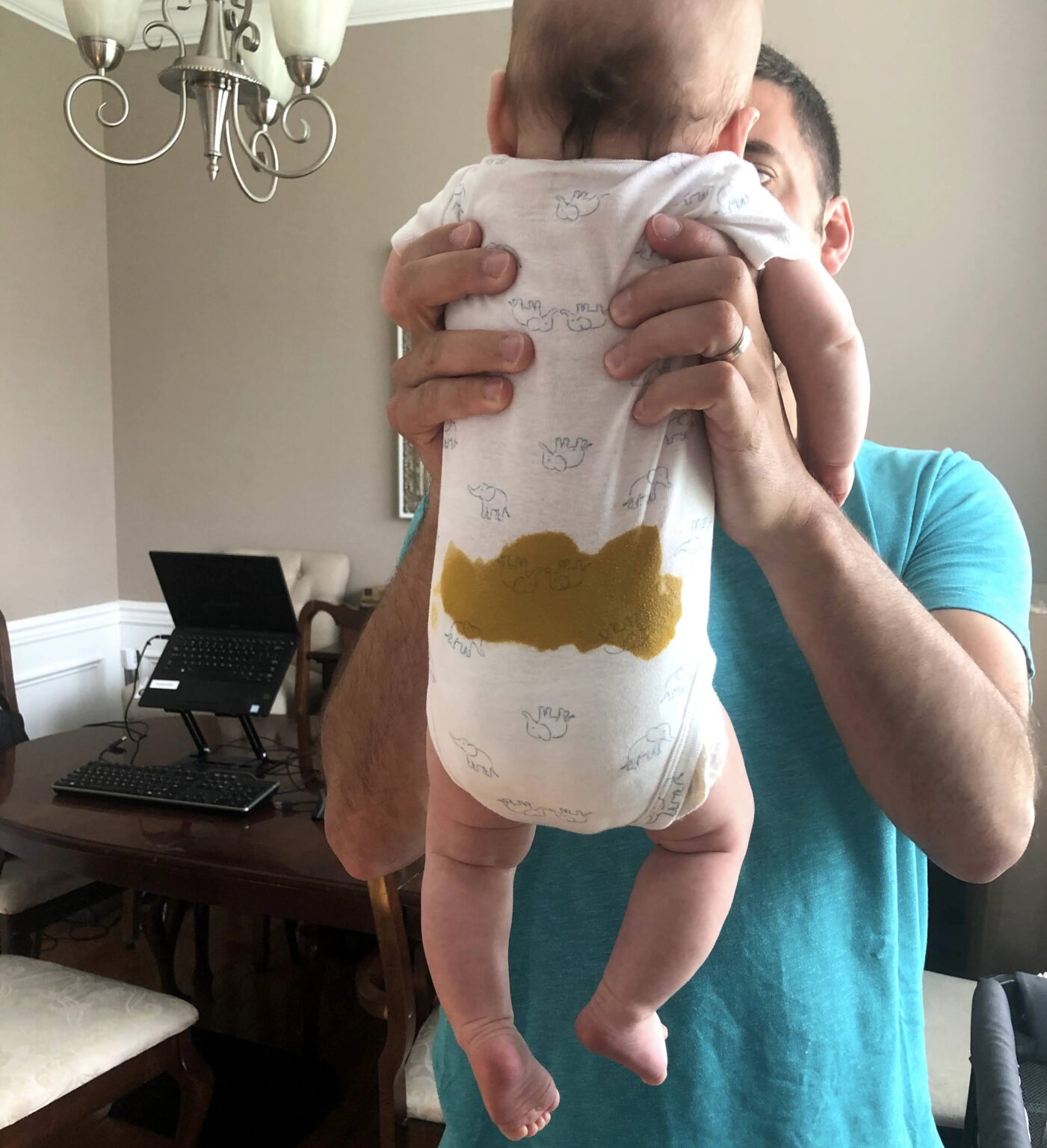 Diaper Blowout: What Every Parent Should Know - Just Simply Mom