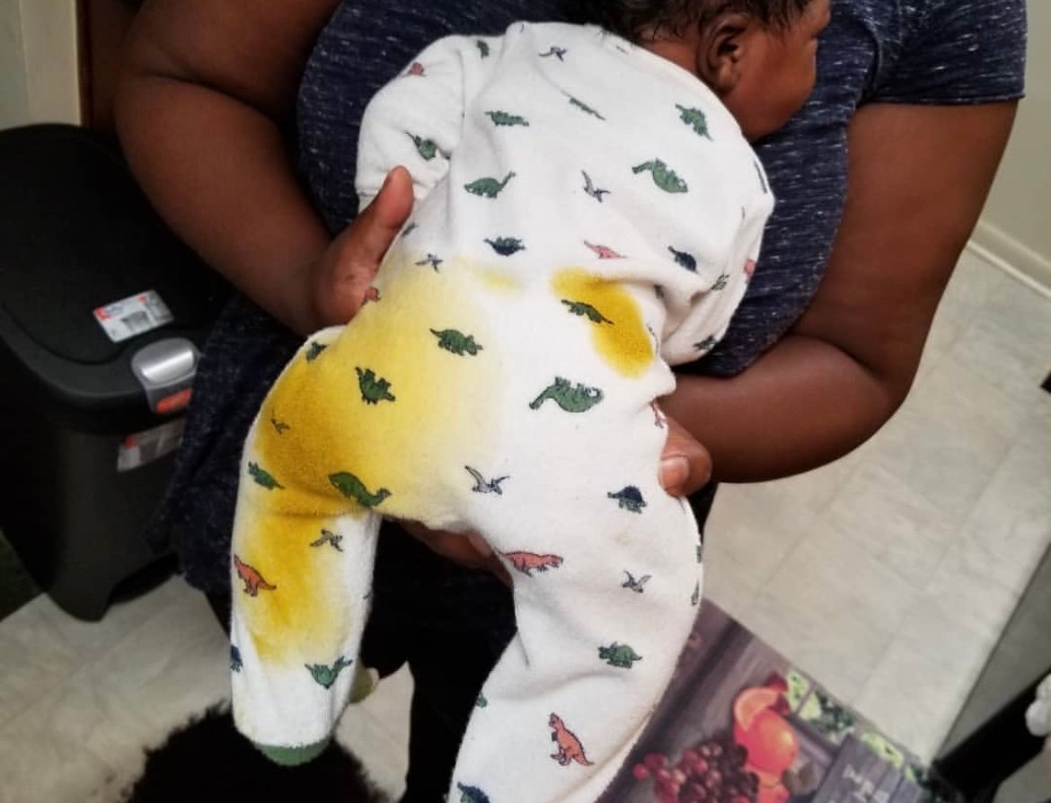 Diaper Blowout: What Every Parent Should Know - Just Simply Mom