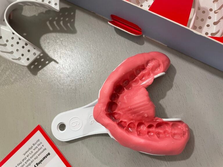 Byte Teeth Aligner Trial Before and After Review - Just Simply Mom