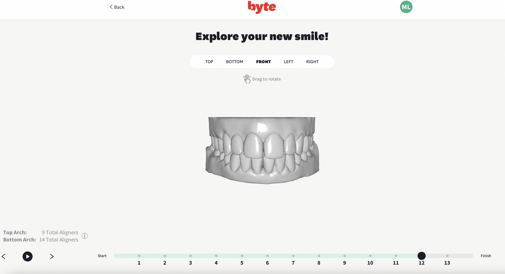 Byte Teeth Aligner Trial Before and After Review - Just Simply Mom