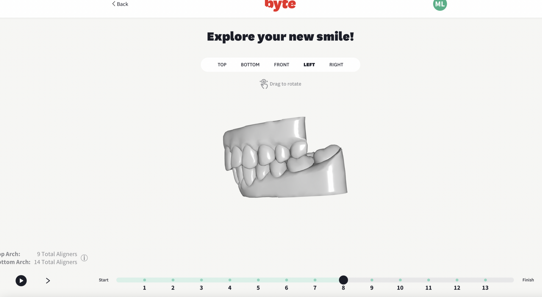 Byte Teeth Aligner Trial Before and After Review - Just Simply Mom