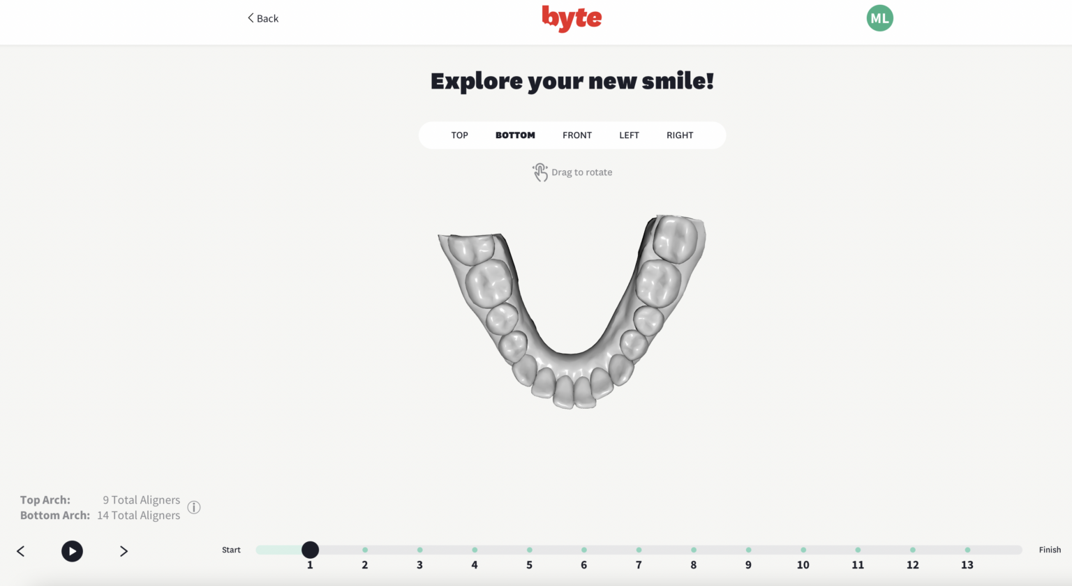 Byte Teeth Aligner Trial Before and After Review - Just Simply Mom