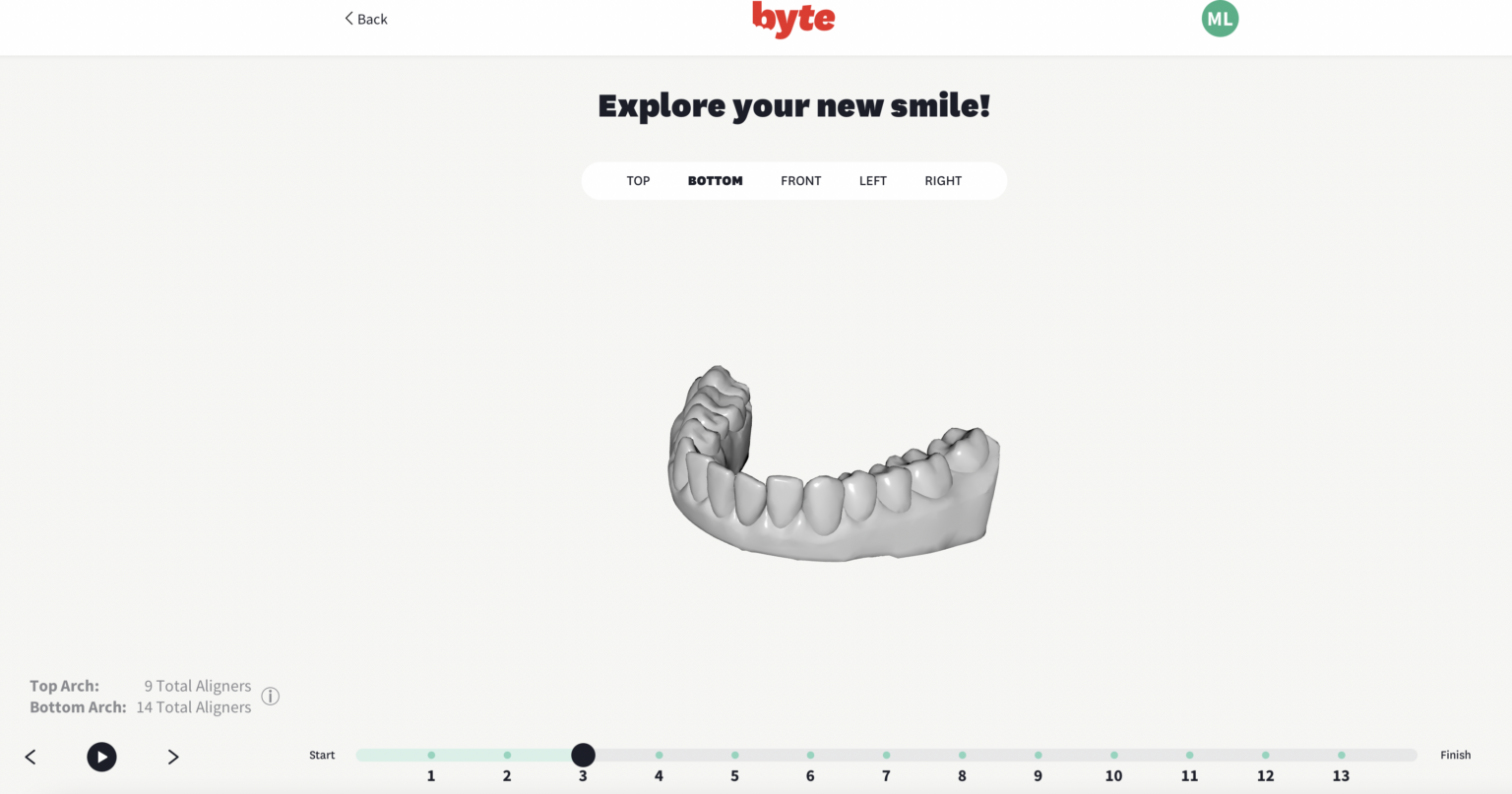 Byte Teeth Aligner Trial Before and After Review - Just Simply Mom
