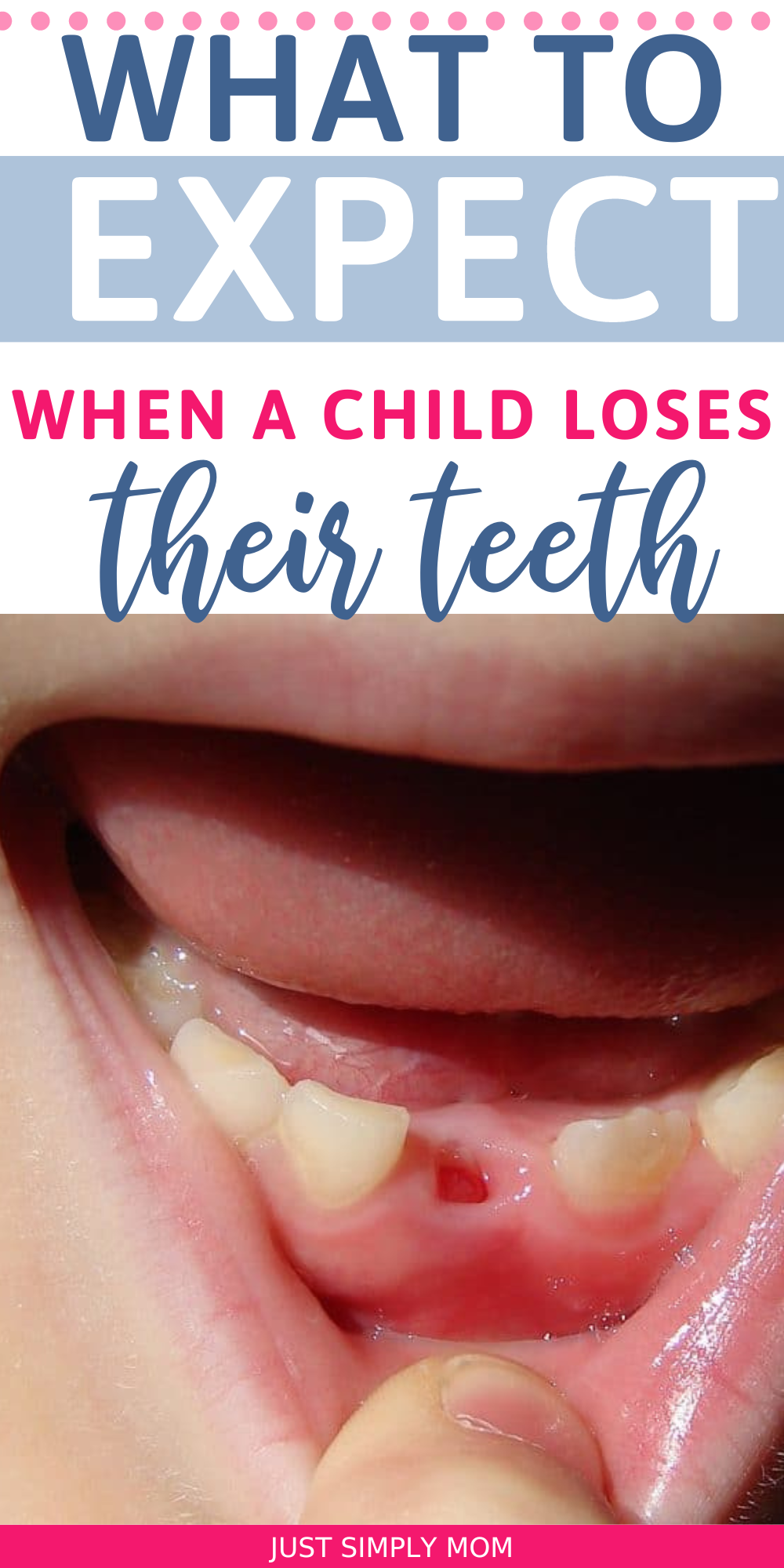 What to Expect When a Child Loses their Baby Teeth - Just Simply Mom